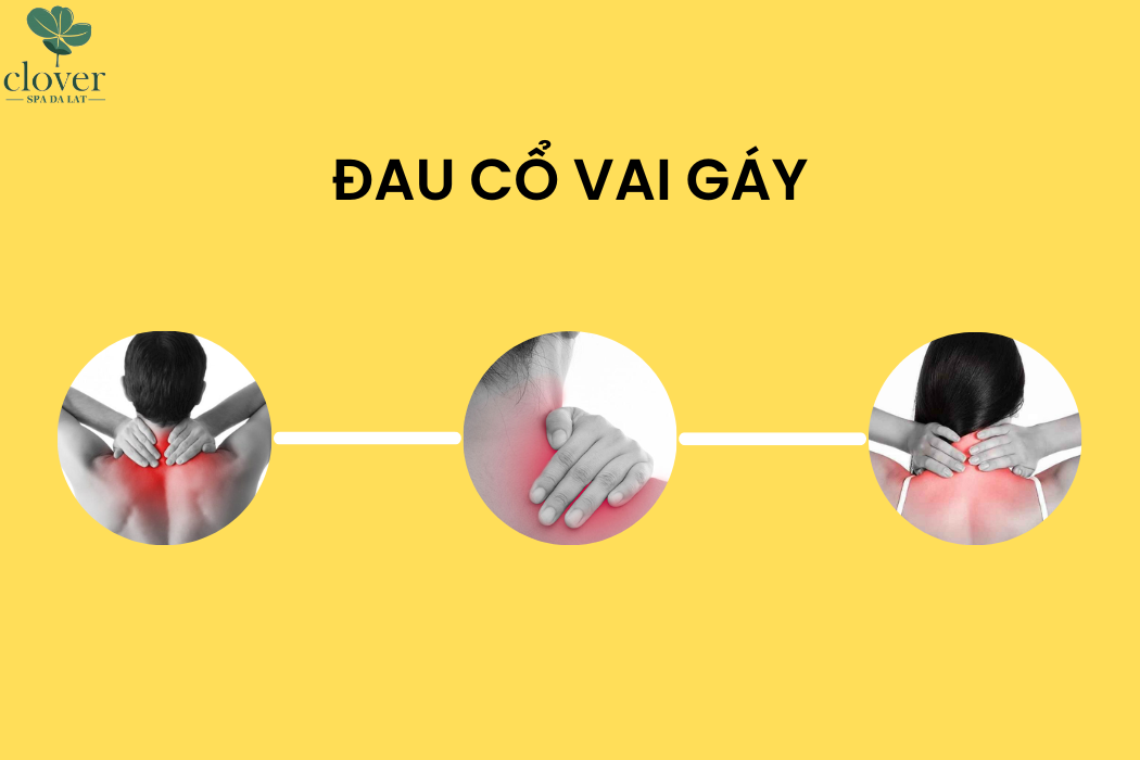 Đau Cổ Vai Gáy